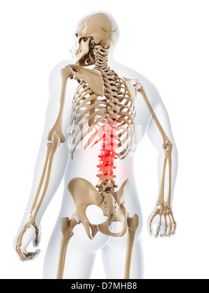 Lower back pain, conceptual illustration Stock Photo - Alamy