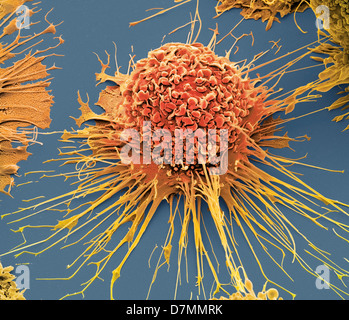 Macrophage. Coloured scanning electron micrograph (SEM) of a macrophage white blood cell ...