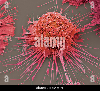 Activated macrophage. Coloured scanning electron micrograph (SEM) of an active macrophage white ...