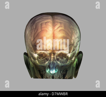Human head, 3D CT and MRI scans Stock Photo - Alamy