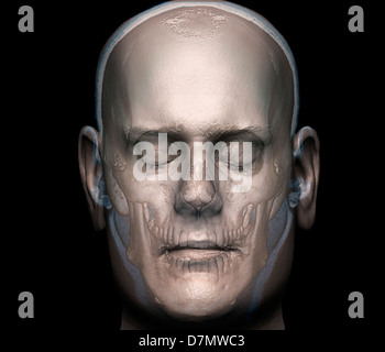 HEAD, 3D SCAN Stock Photo - Alamy