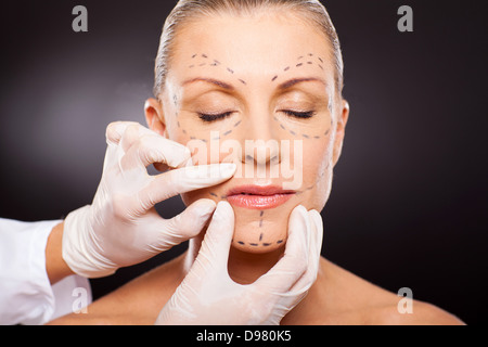 The face of mid age woman before plastic surgery. Senior female model ...