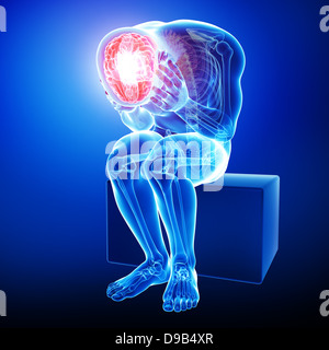 Human headache anatomy Stock Photo - Alamy