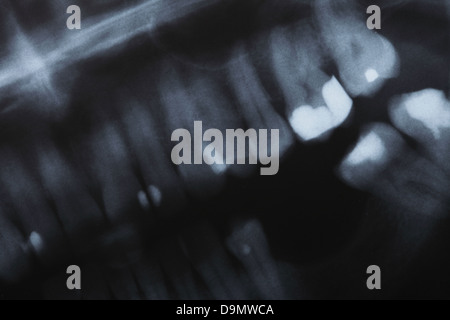 detail x-ray image scan of humans teeth Stock Photo - Alamy
