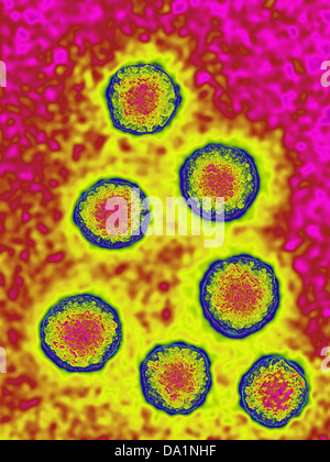 Electron micrograph of Hepatitis E viruses (HEV Stock Photo - Alamy