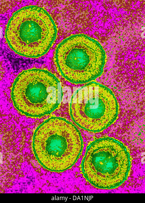 transmission electron micrograph of varicella zoster virions from ...