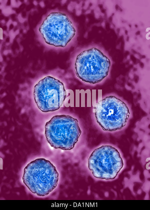Transmission Electron Micrograph (TEM) of poliovirus, an RNA ...