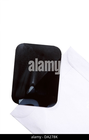 detail x-ray image scan of humans teeth Stock Photo - Alamy