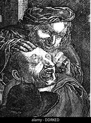 Surgeon, 17th Century Stock Photo - Alamy