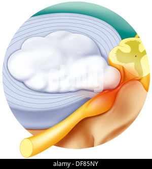 Spinal canal, spinal cord and nerves Stock Photo - Alamy