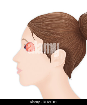 The eye as a camera. Eyeball with cornea and lens, where rays undergo ...