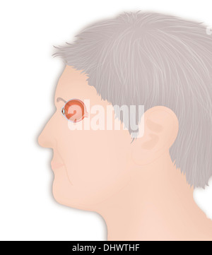 The eye as a camera. Eyeball with cornea and lens, where rays undergo ...