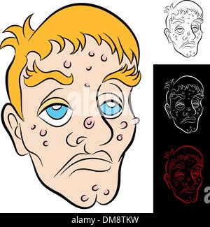 An image of a man with face blemishes Stock Vector Image & Art - Alamy