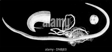 Ascaris lumbricoides is a parasitic roundworm that infects the ...