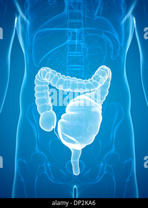 Toxic megacolon, artwork Stock Photo - Alamy