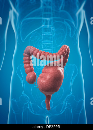 Toxic megacolon, artwork Stock Photo - Alamy