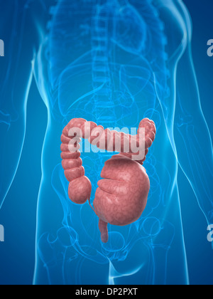 Toxic megacolon, artwork Stock Photo - Alamy