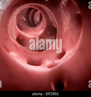 Colon diverticuli, artwork Stock Photo - Alamy
