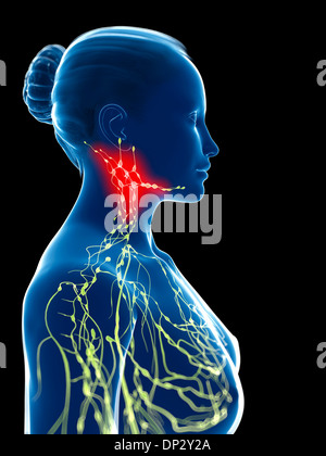 Inflamed lymph nodes artwork Stock Photo - Alamy