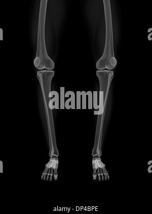 Bowed legs, artwork Stock Photo - Alamy