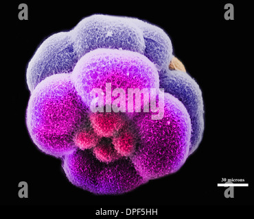 Sea urchin embryo, 16-cell stage, light micrograph. These 16 identical ...