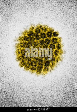 Papilloma virus. Coloured transmission electron micrograph (TEM) of ...