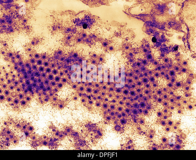 Transmission electron micrograph (TEM) of Reovirus type-3 Stock Photo ...
