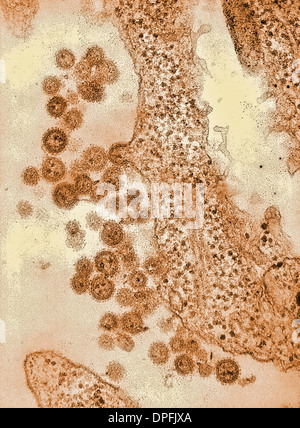 Electron photomicrograph of the Machupo Virus Stock Photo - Alamy