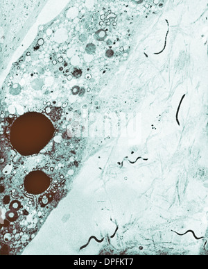 Electron micrograph of Treponema pallidum bacteria Stock Photo - Alamy