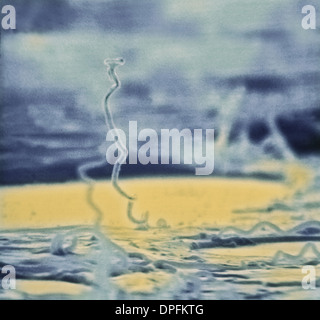 Electron micrograph of Treponema pallidum bacteria Stock Photo - Alamy