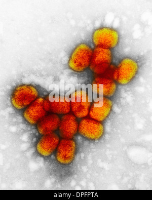 Smallpox viruses. Coloured transmission electron micrograph (TEM) of ...