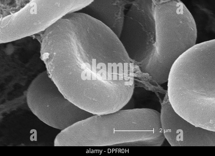 SEM showing rbcs and fibrin Stock Photo - Alamy