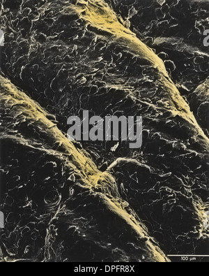 Skin. Coloured scanning electron micrograph(SEM) of a section through ...