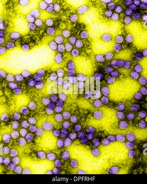 YELLOW FEVER VIRUS Stock Photo - Alamy