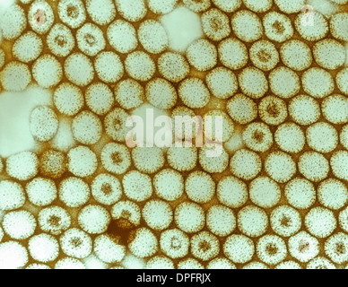 Reovirus infection. Coloured transmission electron micrograph (TEM) of ...