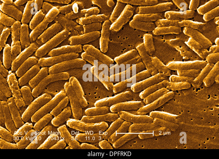Scanning electron micrograph (SEM) of Salmonella typhi is a Gram ...