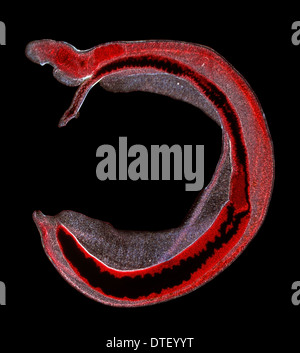Schistosoma spp., blood fluke Stock Photo - Alamy