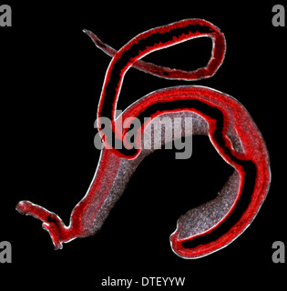 Schistosoma spp., blood fluke Stock Photo - Alamy