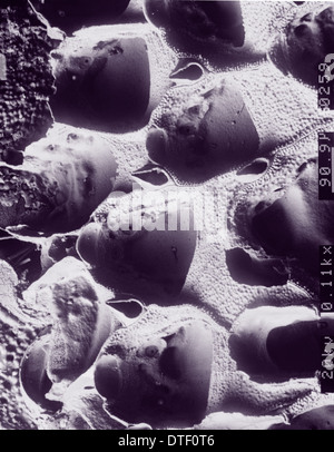 Scanning electron micrograph (SEM) of Bryozoan, lophophorate animals ...