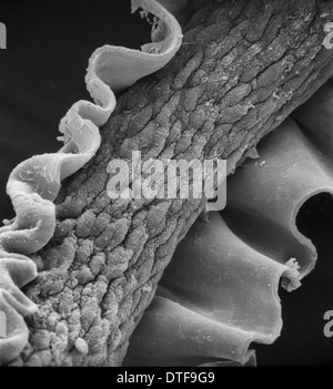 Human hair. Scanning electron micrograph (SEM) of human hairs emerging ...