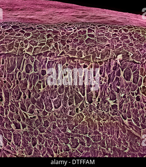 Red grape (Vitis sp.), coloured scanning electron micrograph (SEM Stock ...