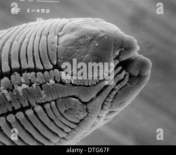 Scanning electron micrograph (SEM) of Nematode (Trichuris sp.) helminth ...