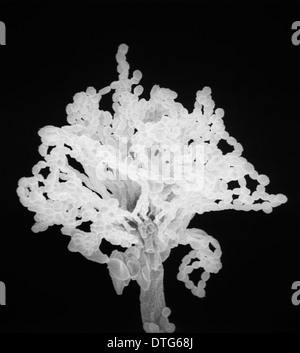 Scanning electron micrograph (SEM) of Mould conidiophores (fruiting structures) and conidia ...