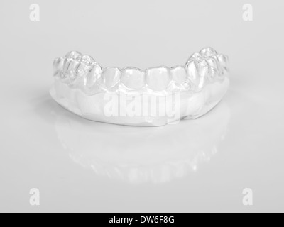 Translucent upper essix retainer on a plaster study model placed on a ...