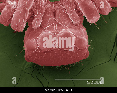Scanning Electron Microscope image of a Spider (12 x magnification ...