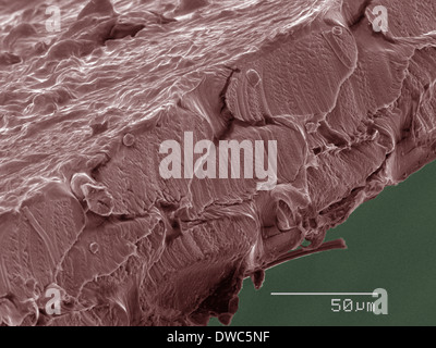 Oral hygiene. Coloured scanning electron micrograph of bacteria ...