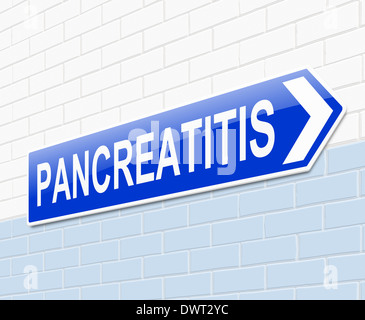 Pancreatitis, conceptual illustration Stock Photo - Alamy