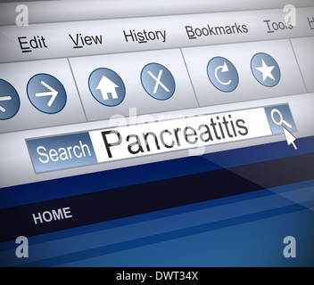 Pancreatitis, conceptual illustration Stock Photo - Alamy