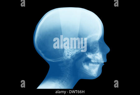 Retrogenia chin Stock Photo - Alamy