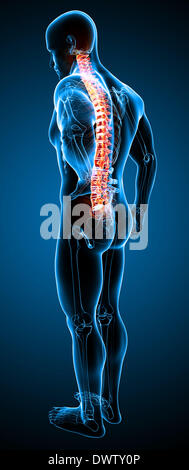 Back pain man drawing Stock Photo - Alamy
